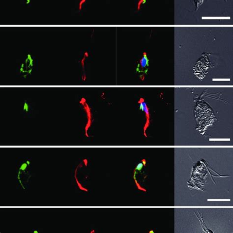 Immunofluorescence Localization In T Vaginalis Of The Five Download Scientific Diagram