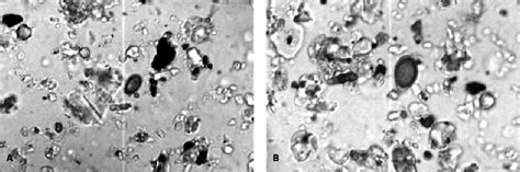 Photomicrographs Of Two Ganoderma Basidiospores Recorded From Saudi Download Scientific Diagram