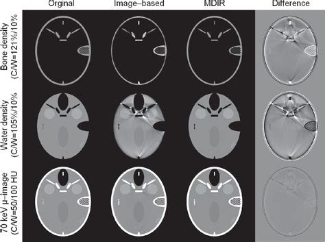 Figure 2 From Dual Energy Ct Material Decomposition From Inconsistent Rays Mdir Semantic Scholar