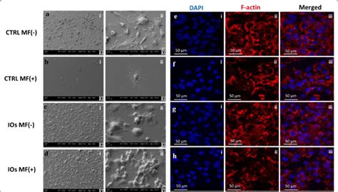 Ios And Mf Affect Morphology Of Osteoclasts Ios Mf And Their