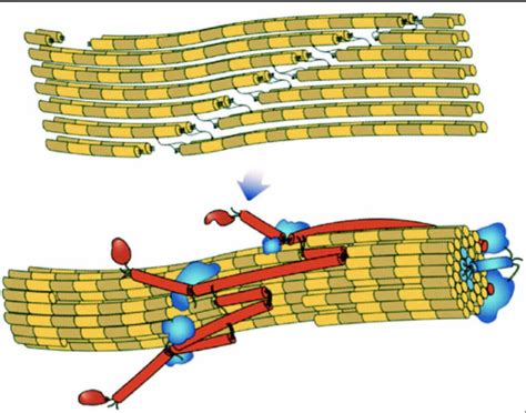 Understanding Corneal Cross Linking