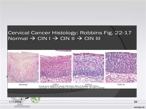 умайн хүзүүний хорт хавдар