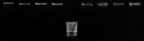 Genomic Dna Resulted From Ctab Dna Extraction Method From Left To