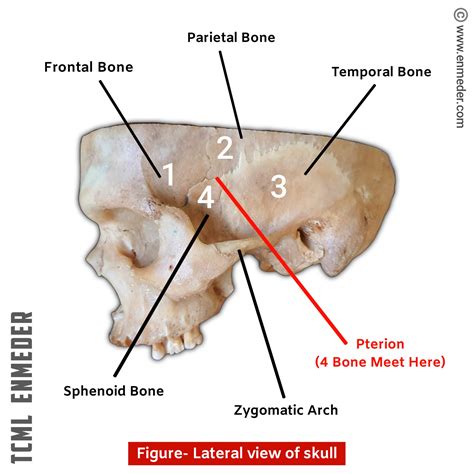 Pterion Tcml The Charsi Of Medical Literature