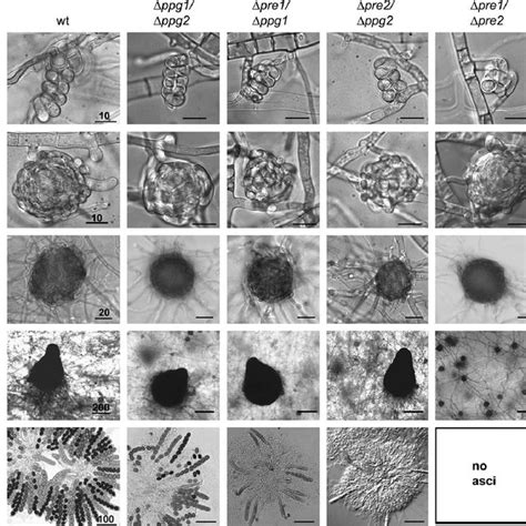 Microscopic Investigation Of Sexual Developmental Stages Of The Download Scientific Diagram