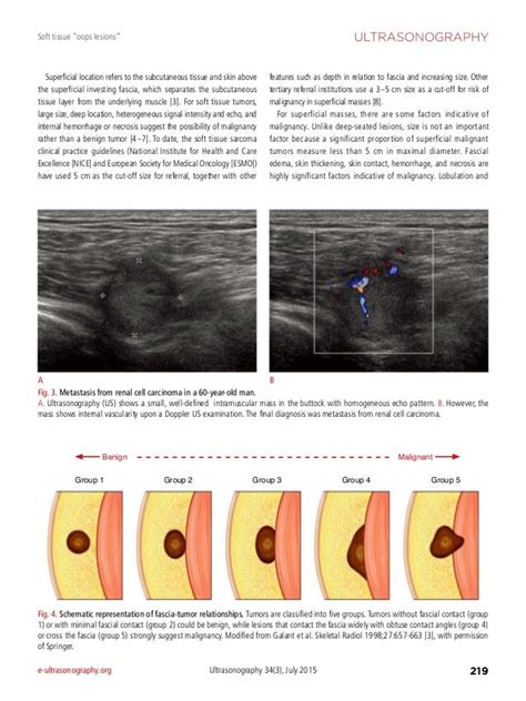 Diagnostic Ultrasound Soft Tissue