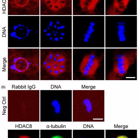 Subcellular Localization And Protein Expression Patterns Of Hdac8