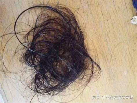 掉头发如何改善 知乎