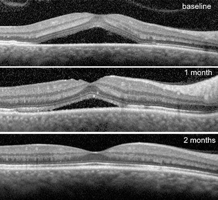 Curriculum Vitae Daniel Palanker