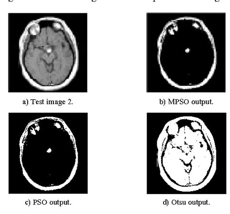 Table 1 From Brain Tumor Segmentation In Mri Images Using Integrated