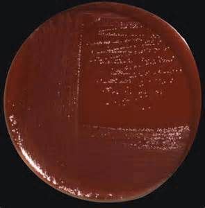 Figure 2 Campylobacter Jejuni Culture Grown On Skirrows And Butzler