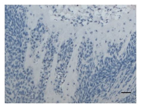 Immunohistochemistry Of Runx2 And Osterix In Mandibular Osteoblasts Of