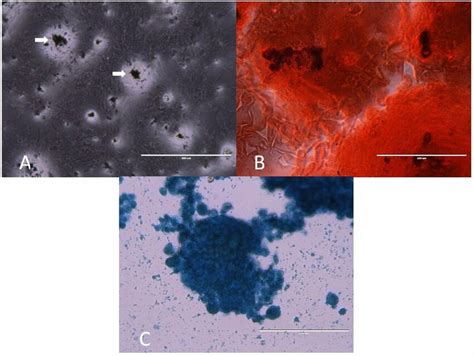 cell differentiation analysis in a photomicrograph of mac cells