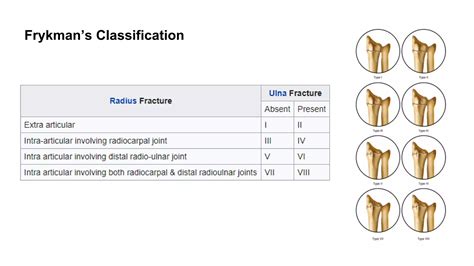 Distal Radius Fracture Pptx