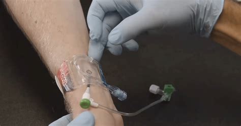 Preludesync Evo™ Radial Compression Device Merit Medical