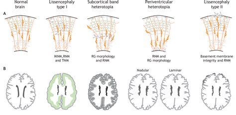 Table 1 From Neuronal Migration In The Cns During Development And Disease Insights From In Vivo