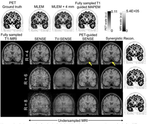 Figure 1 From Multi Modal Weighted Quadratic Priors For Robust Intensity Independent Synergistic