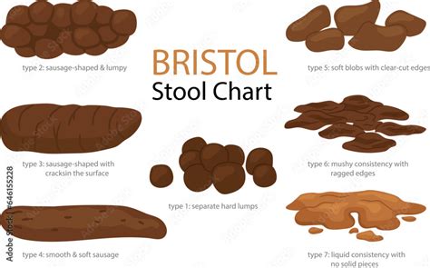 Bristol Stool Form Scale With Faeces Type Images Set Of Different
