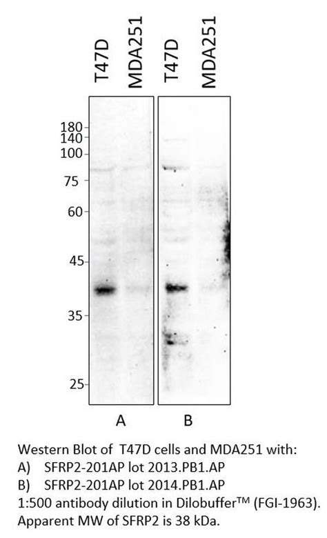 Sfrp2 Polyclonal Antibody Sfrp2 201ap Sfrp2 Polyclonal Antibody Sfrp2 201ap
