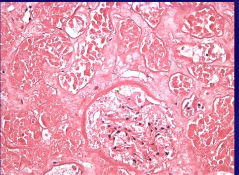 【病理学备考笔记】 细胞、组织的适应与损伤（含名词解释、问答题） 哔哩哔哩