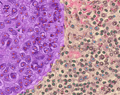 Ap Laboratory Solutions