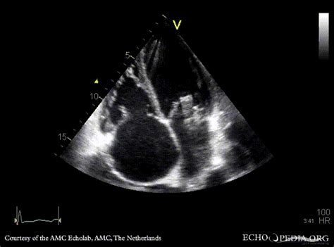 Filee00454 Echopedia