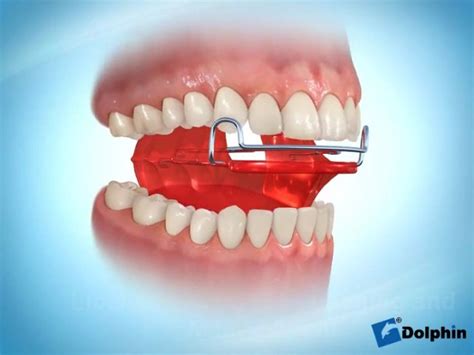 Doctors Videos Backup Dentistry Bionator [hq]