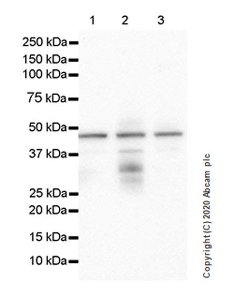 Anti Runx1 Aml1 Antibody Chip Grade Epr23309 113 Ab272456 Abcam