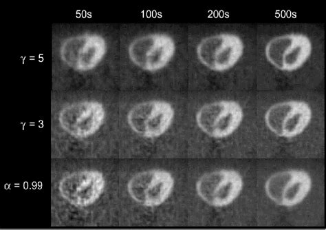 Figure 2 From Iterative Reconstruction Of Spect Data With Adaptive
