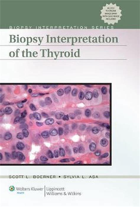 Biopsy Interpretation Of The Thyroid Sylvia L Asa 9780781772044