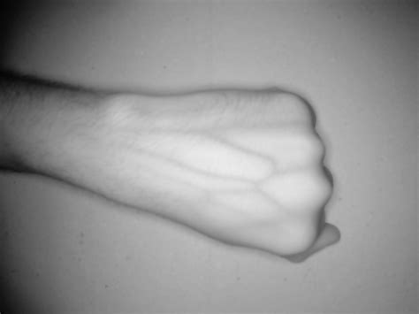 a fast simple and powerful contrast enhancement algorithm for image analysis codeproject