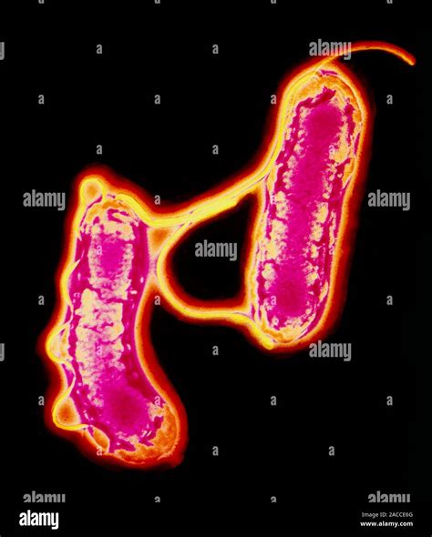 Helicobacter Pylori Coloured Transmission Electron Micrograph Of Two