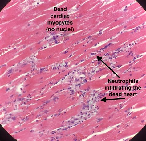 Cardiac Muscle Histology Myocyte