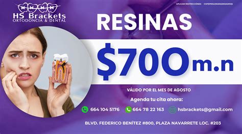 Hs Brackets 🔹🦷buscas Arreglar Tus Dientes Pero No Te Sientes Cómodo Con Brackets Notables🦷🔹
