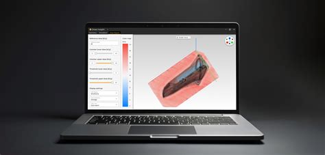 Design For Sterilization Dfs Triple Ring Technologies