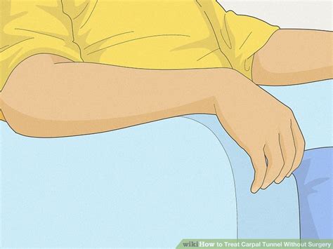Ways To Treat Carpal Tunnel Without Surgery Wikihow