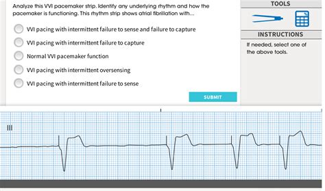 Solved Analyze This Vvi Pacemaker Strip Identify Any
