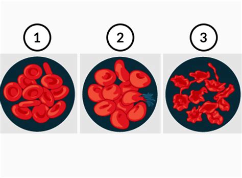 Extracellular Fluid Diagram Quizlet