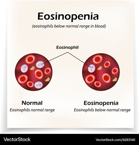What Is The Normal Range Of Eosinophils In The Blood British Journal