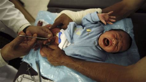 Circoncire Cest Prévenir Slatefr