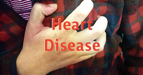 Early Cholesterol Treatment Lowers Heart Disease Risk Study New