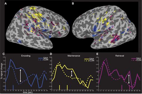 Spatial Localization Of Fmri Activity Differences On Inflated Surface