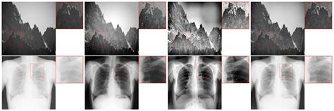 Real Time Clahe Algorithm Implementation In Soc Fpga Device For 4k Uhd