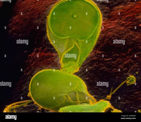 Giardia Lamblia Coloured Scanning Electron Micro Graph Sem Of The