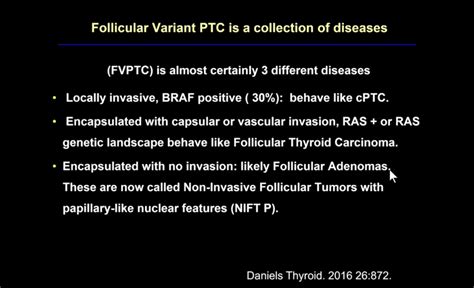 Follicular Variant Of Ptc Rodrigo Arrangoiz Ms Md Facs Fsso