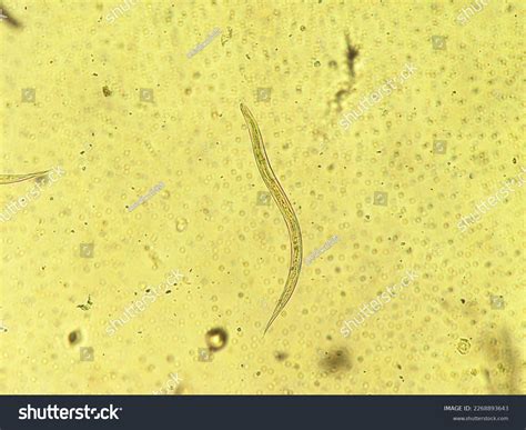 Hookworms Microscope