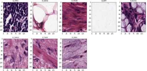Figure 4 From Colorectal Multi Class Image Classification Using Deep