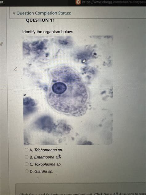 Solved Question Completion Status QUESTION 11Identify The Chegg