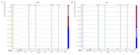 Fnirs Analysis Toolbox Series Mnepython Artinis Medical Systems Fnirs And Nirs Devices
