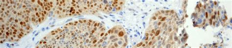 What You Need To Know About The Oncogene C Myc